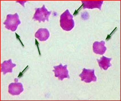 soit être éliminés de la